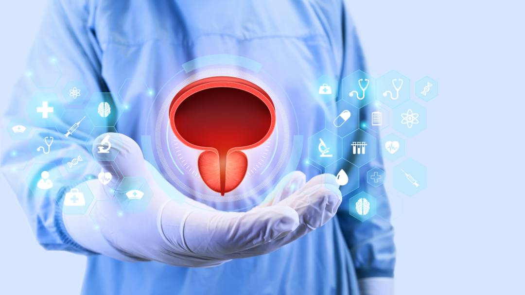 Cirugía de Próstata: Indicaciones, tipos y recuperación | Top Doctors